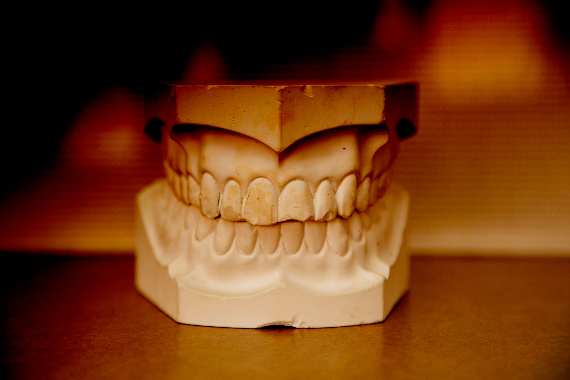 Council Concludes Bite-Mark Analysis Is Junk – The Intercept